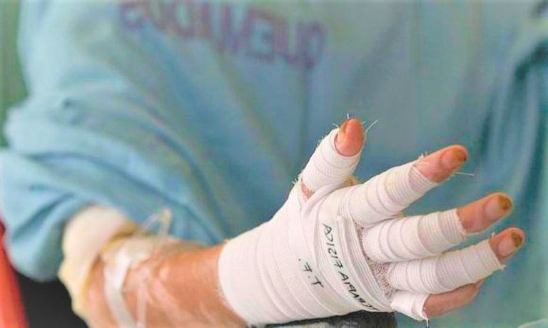 Tres niños luchan por su vida tras incendio causado por pólvora que ...